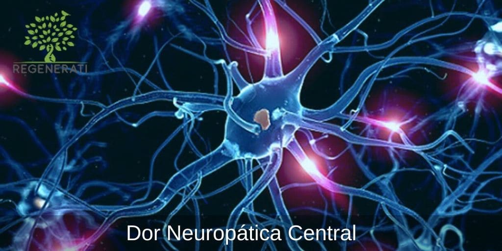Dor Neuropática Central - Saiba Mais | Clinica Regenerati